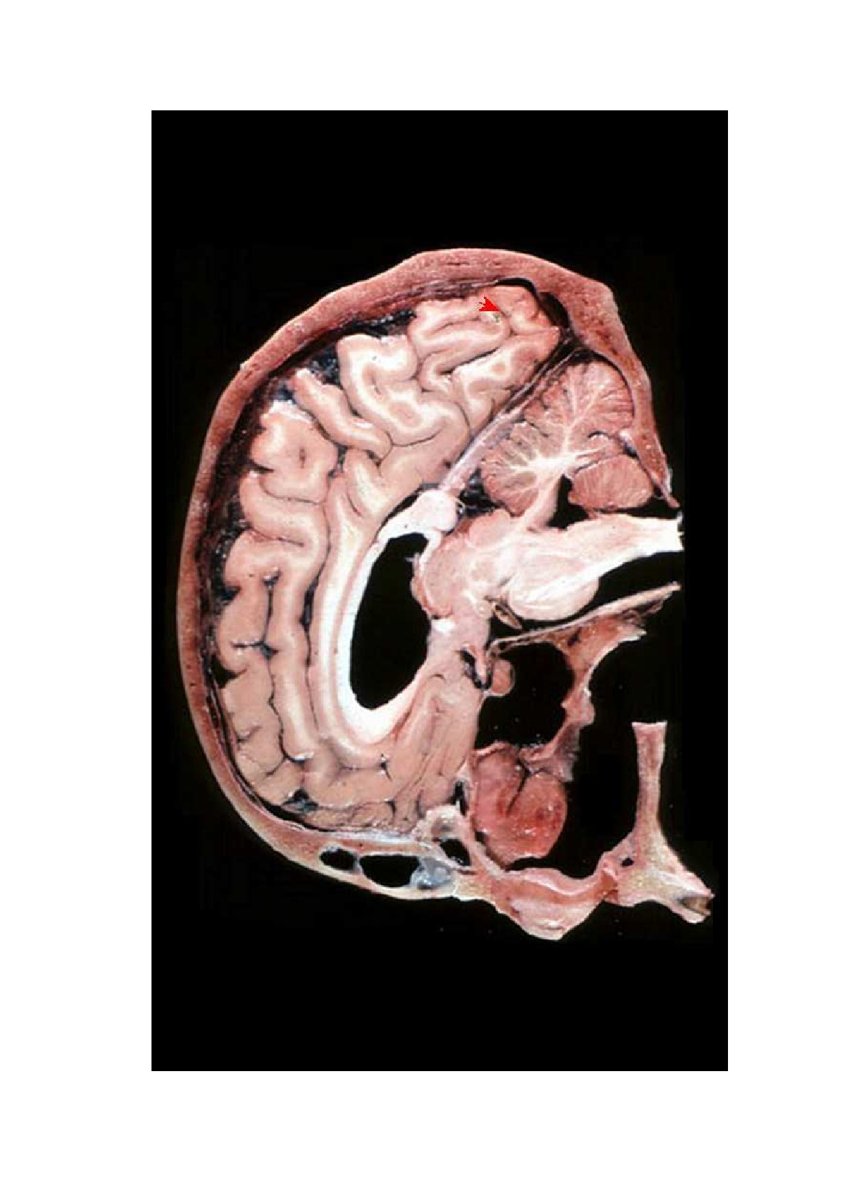 Chapitre 2 - Cerveau et vision (aires cérébrales et plasticité ...