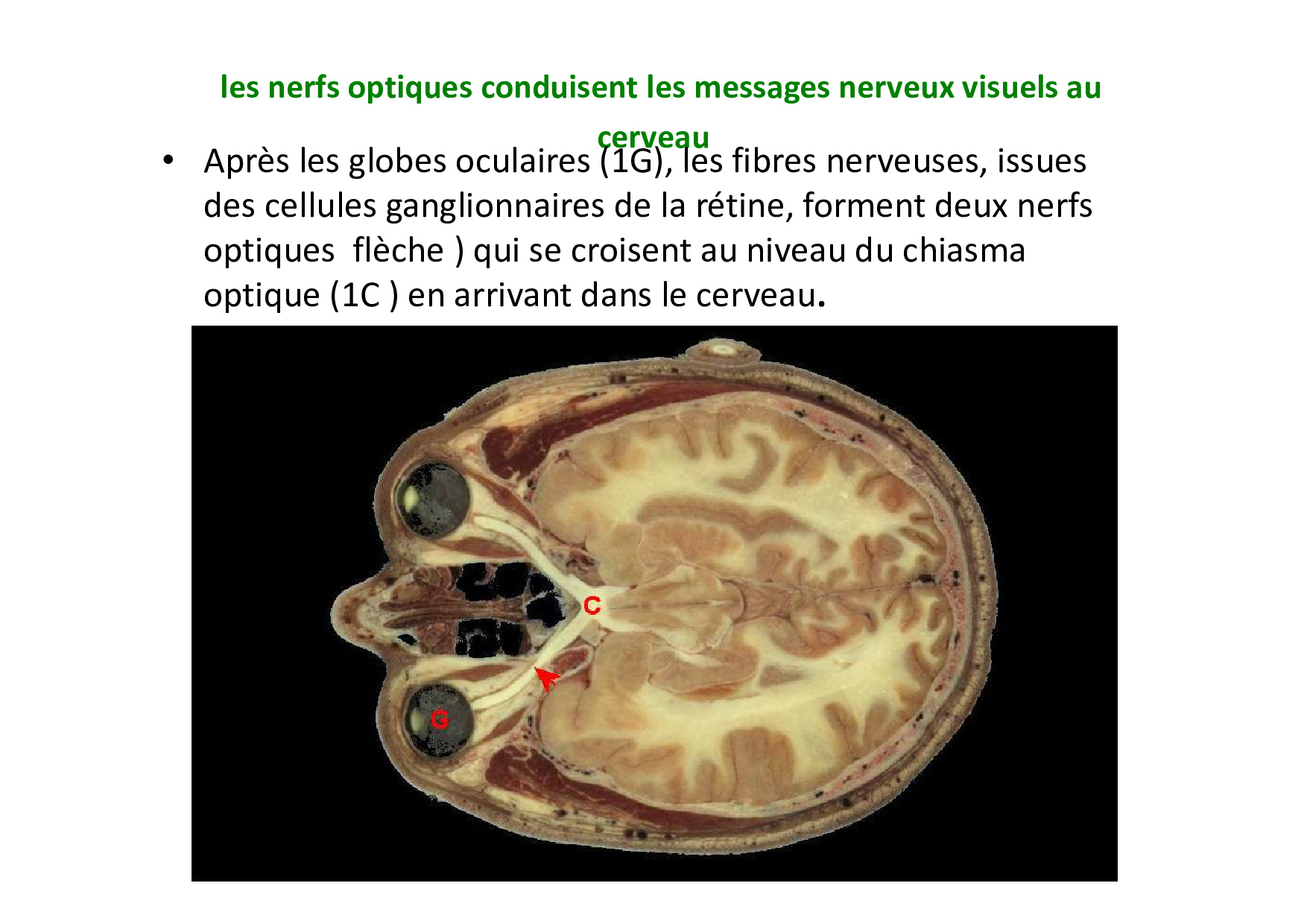 Chapitre 2 - Cerveau et vision (aires cérébrales et plasticité ...