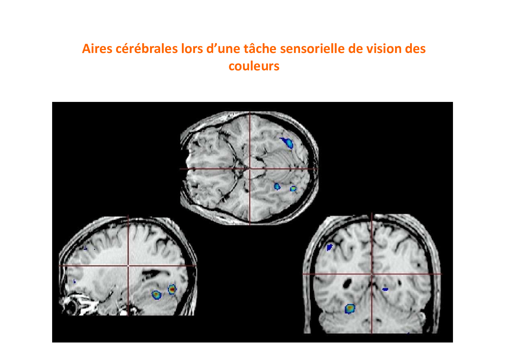 Chapitre 2 - Cerveau et vision (aires cérébrales et plasticité ...