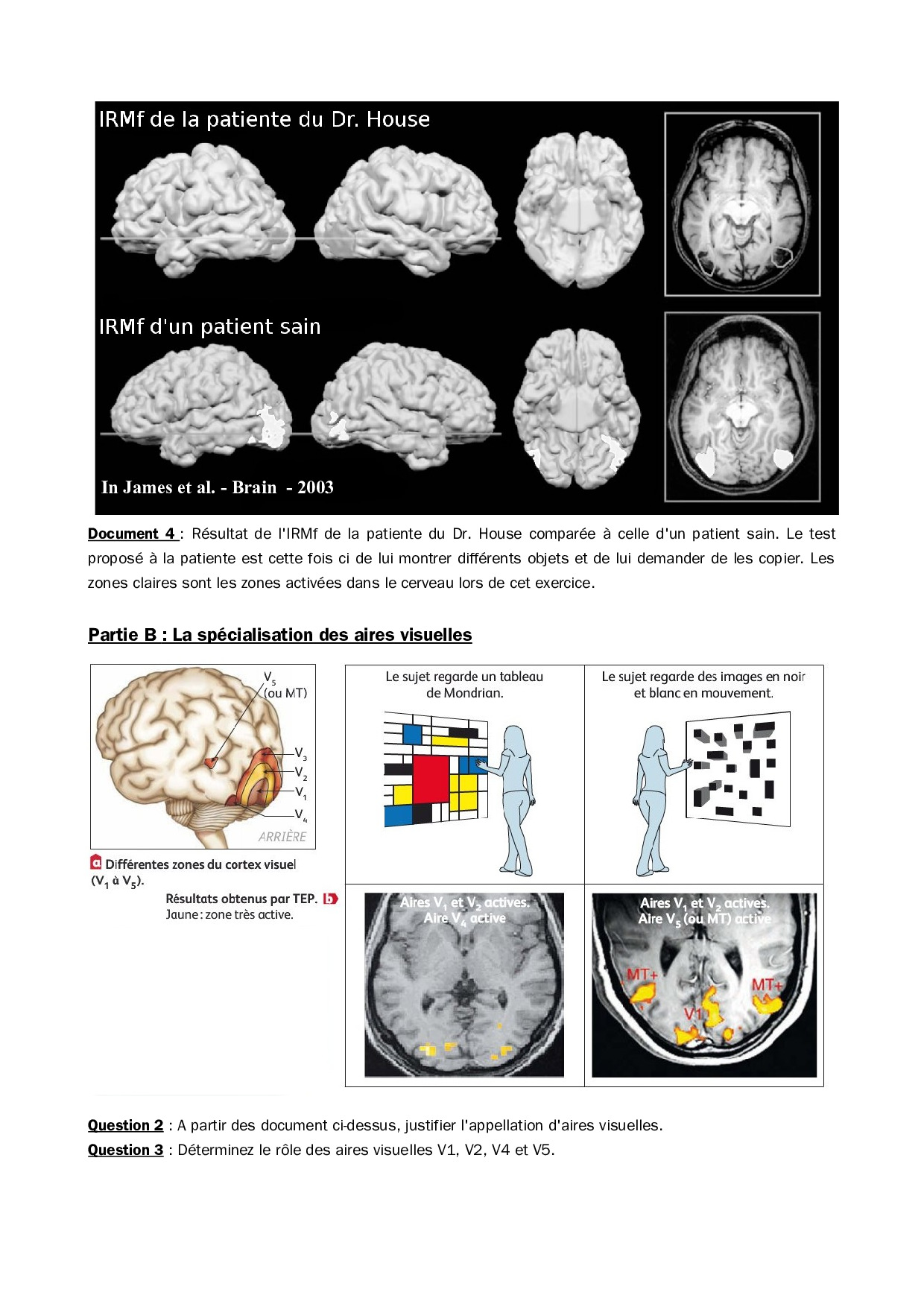 Représentation visuelle - Activité 6 (Les aires du cerveau impliquées ...
